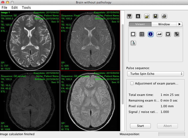 Virtual MRIについて