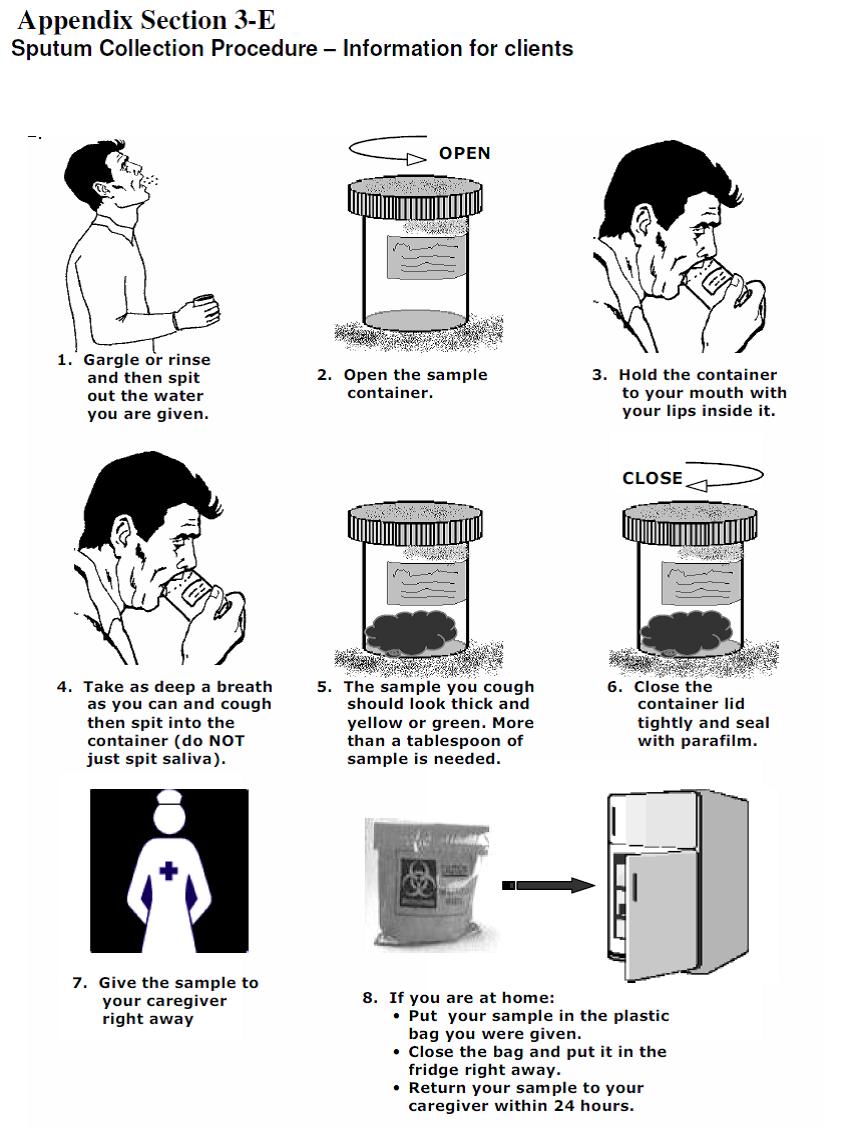 Tuberculosis ( T B ) - Respiratory Diseases