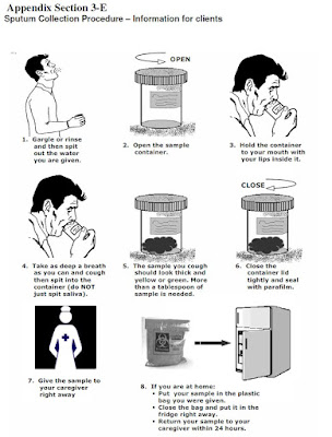 Tuberculosis ( T B ) - Respiratory Diseases