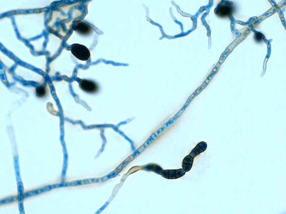 Fun With Microbiology (What's Buggin' You?): July 2015