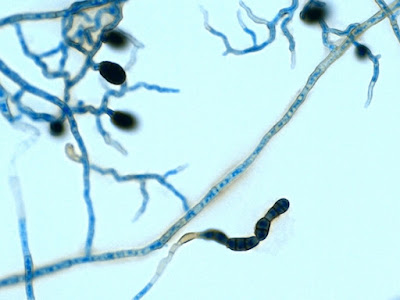 Fun With Microbiology (What's Buggin' You?): Pithomyces species