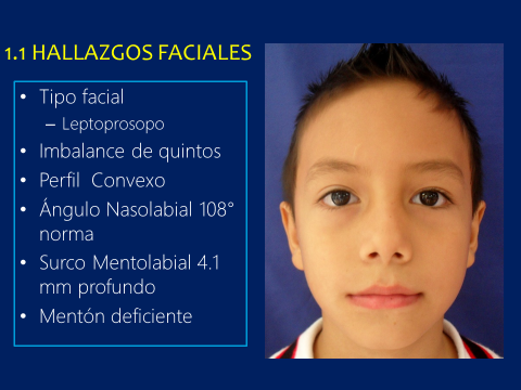 ANALISIS DE SONRISA: ANALISIS DE SONRISA, INTRODUCCION A LA ODONTOLOGIA