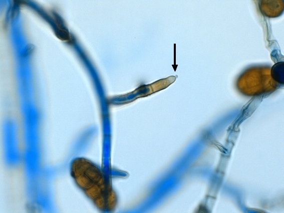 Fun With Microbiology (What's Buggin' You?): Stemphylium species