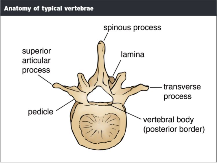 Transverse Process Fractures of the Lumbar Spine
