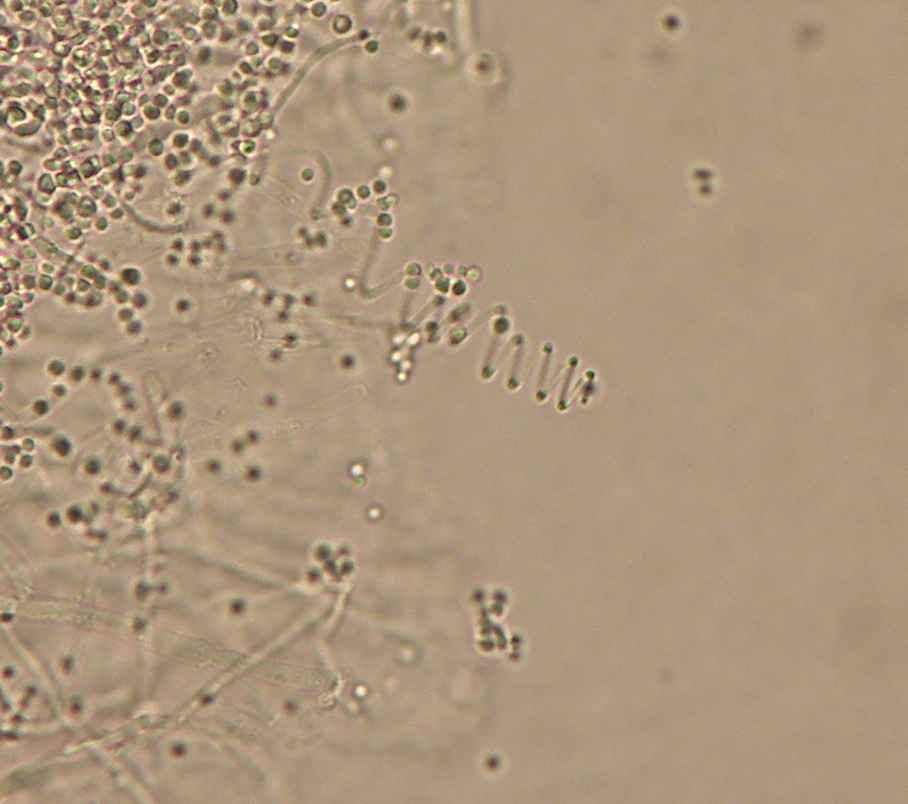 ATLAS MICOLOGIA: TRICHOPHYTON MENTAGROPHYTES