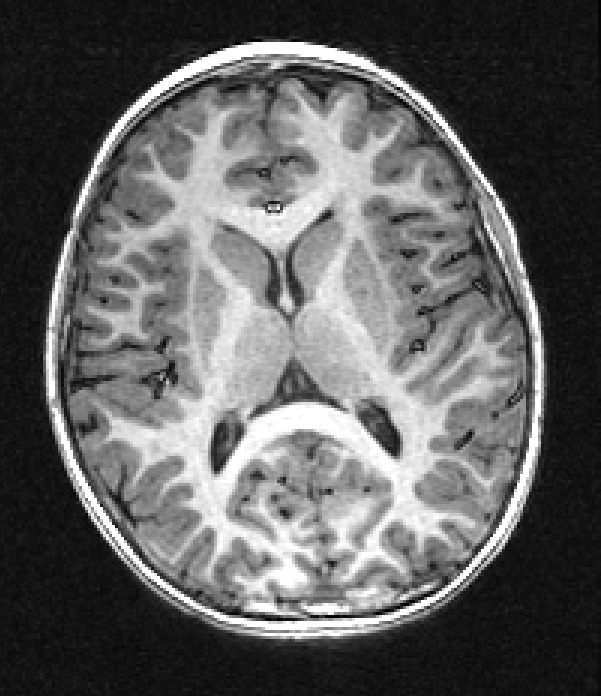 The Playful Spirit: Functional MRI... cool brain mapping!