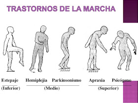 Fisioterapia: Diferentes tipos de marchas patológicas / Rehabilitación ...