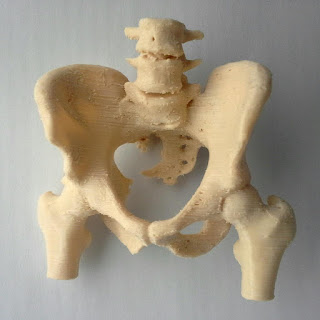 Nevit's blog: How to Create a 3D Print from a Medical Scan