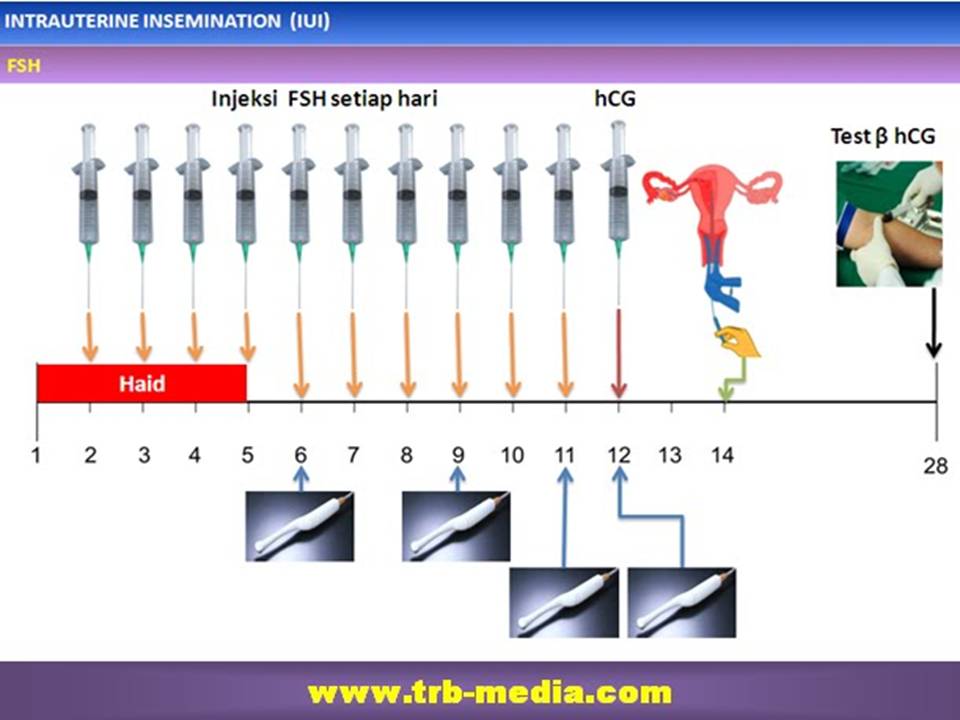 science and technology: How to make a baby