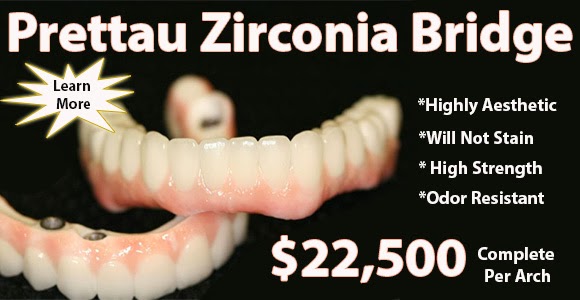 Golpa Dental Implant Center of Las Vegas: Golpa Prettau Zirconia Bridges