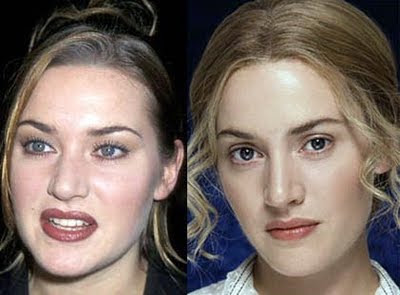 How To Be Stunning: Celebrity Nose Jobs-They've ALL done it!