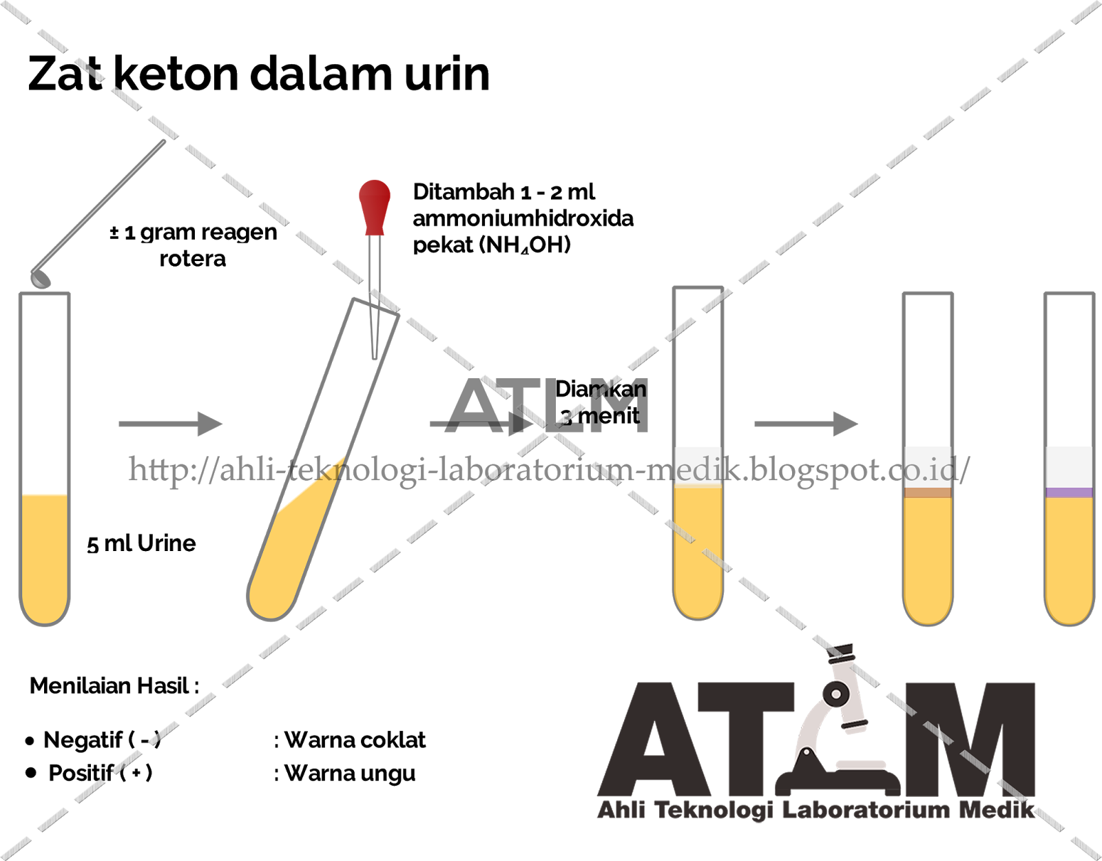 Pemeriksaan Zat Keton Urin Metode Rothera — Online Text Book ATLM