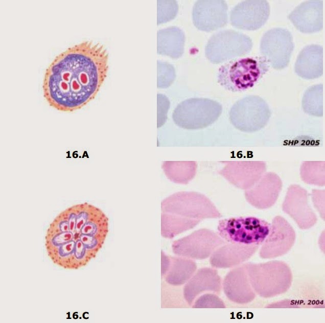 Plasmodium ovale | MedTech