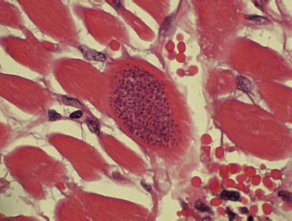 Toxoplasmosis: Patología