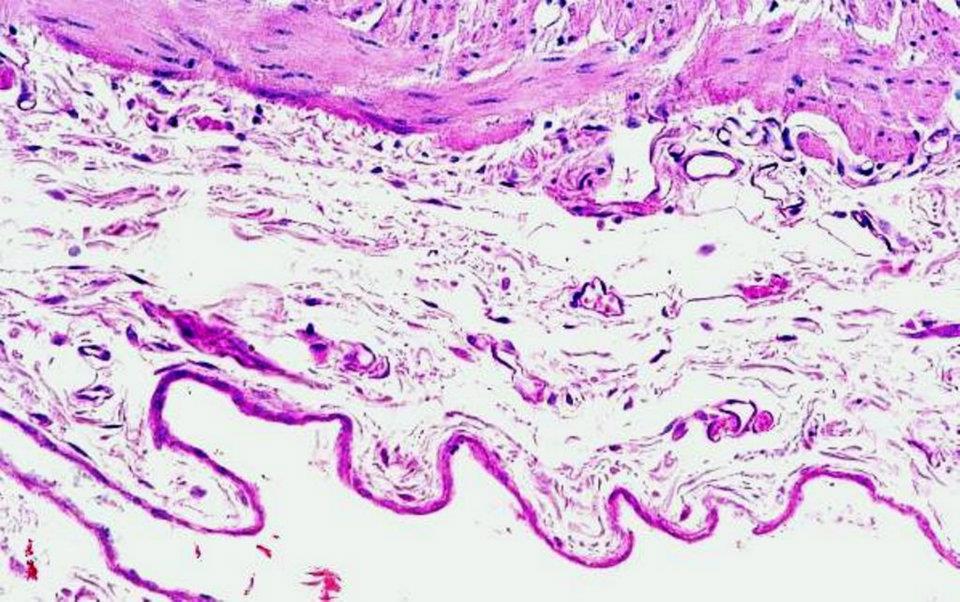 Plantão Médico: HISTOLOGÍA TEJIDO EPITELIAL DE REVESTIMIENTO Y GLANDULAR