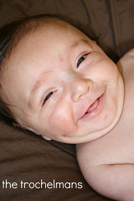 the trochelmans: Skin tag removal on our baby