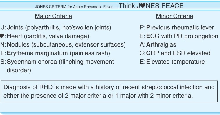 JONES criteria mnemonic for diagnosis of rheumatic heart disease (RHD)