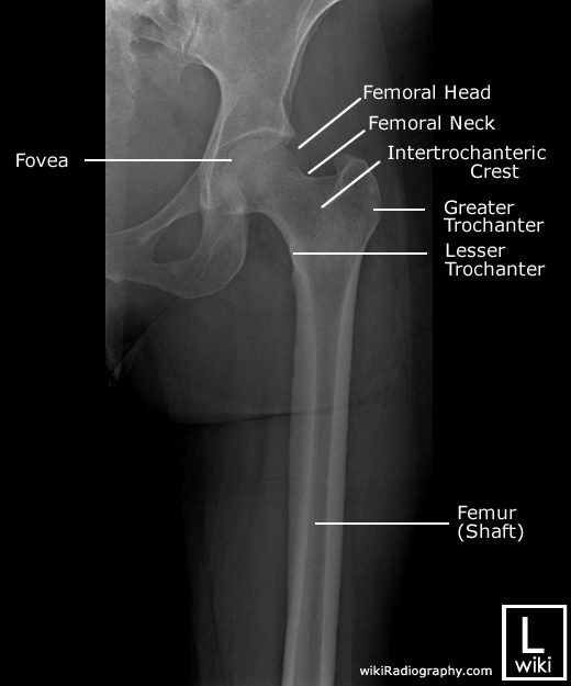 ANATOMI RADIOGRAFI FEMUR - Radiografer