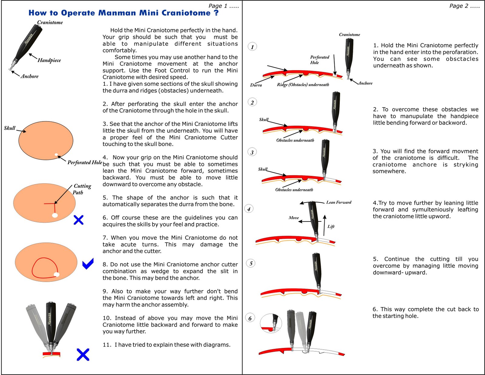 Manman Art Studio: How to Operate Manman Mini Craniotome