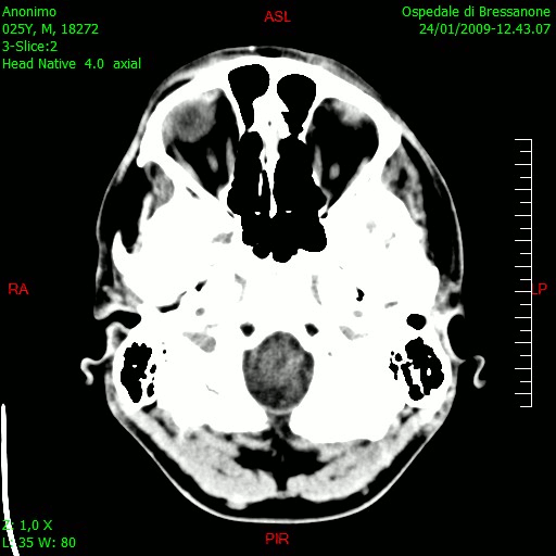 Concetto Piramidale: 01/10/13 - 01/11/13