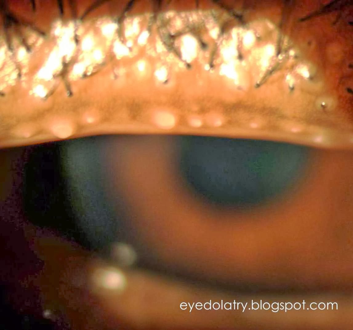 External Photography Bonanza - Eyedolatry