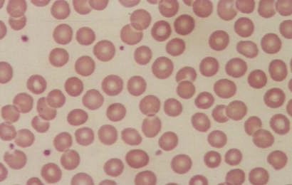 Prácticas Hematología: Práctica 9:Tinción de giemsa. (PIX)(B1)