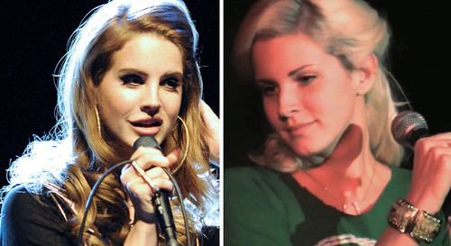 Lana Del Rey Surgery