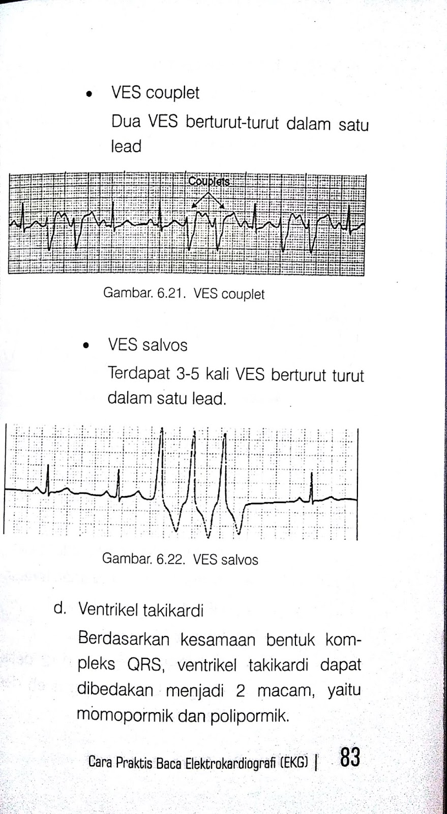 Medsign: Buku Cara Praktis Baca EKG