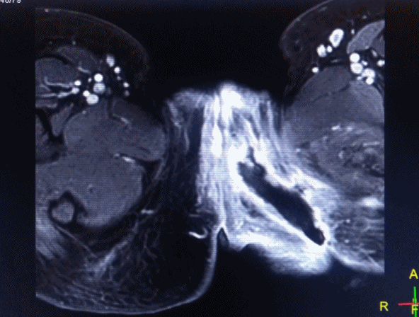 março 2018 ~ Raio X web