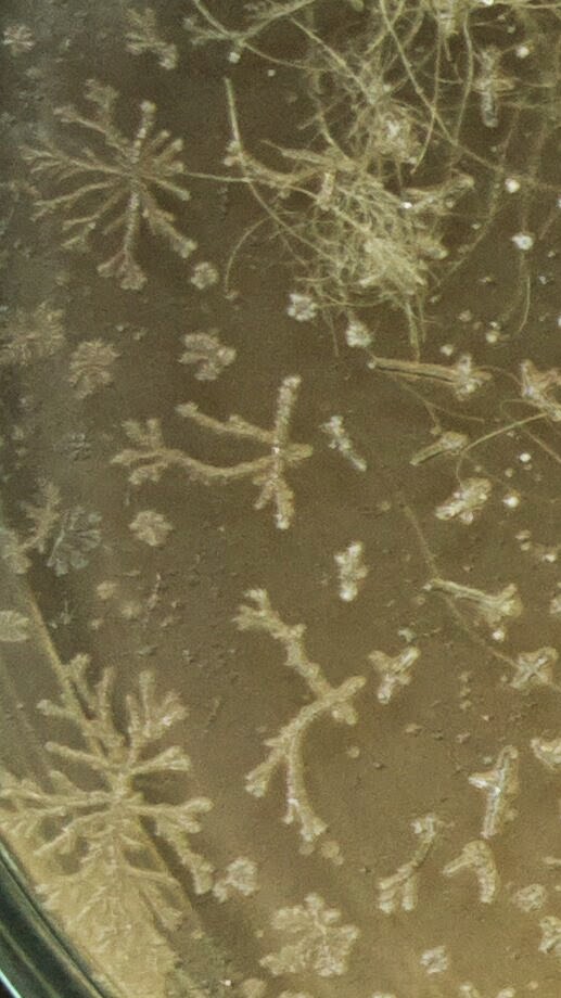 Candida albicans pe mediu de cultura sabouraud cu probe de piele cu ...