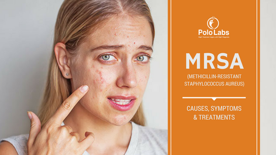 What Is MRSA? Causes, symptoms and treatment