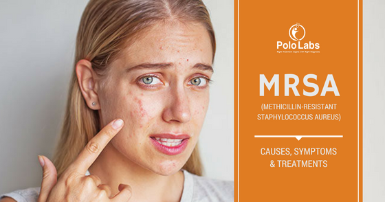 What Is MRSA? Causes, symptoms and treatment