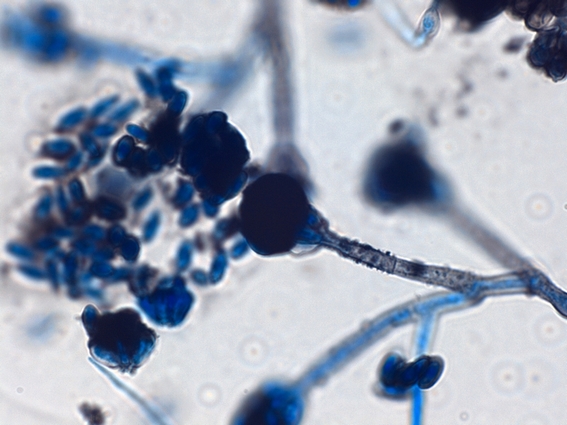 Fun With Microbiology (What's Buggin' You?): Stachybotrys species