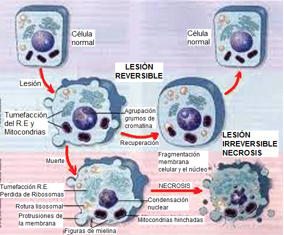 PATOLOGÍA BUCAL: Patología General "Lesión y adaptación celular"