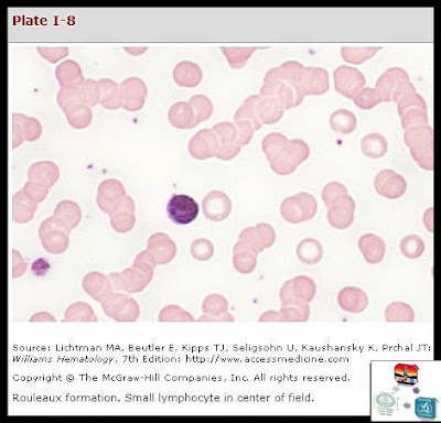 VETERINARY HEMATOLOGY DEXTERVET: rouleaux formation