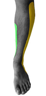 ARES Kinesiology Tape: Shin Splint