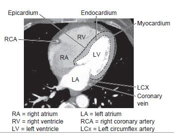 Heart Ct Scan Labeled