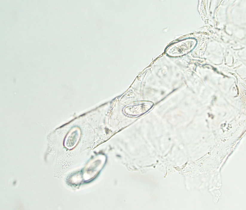 Pinworm Scotch Tape Test