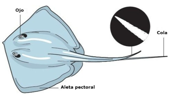 Un dermatólogo en el museo : Picadura de raya