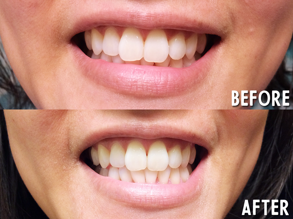 Luster Power White Toothpaste Review – See, Shop, Love!