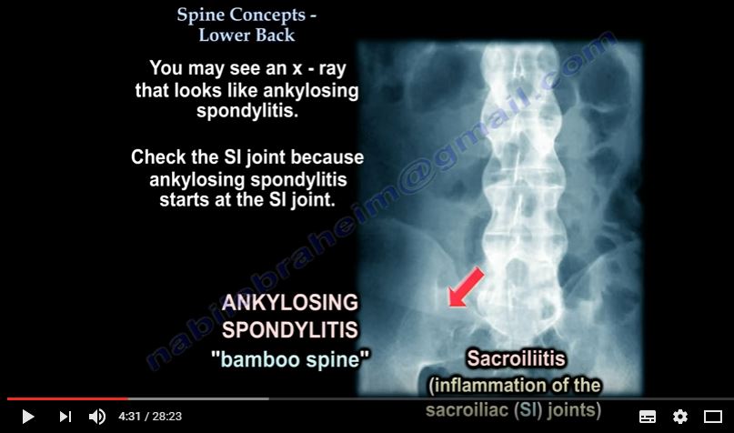 Spine concepts, Lower back ache - DNB Orthopaedics MS Orthopedics MRCS ...