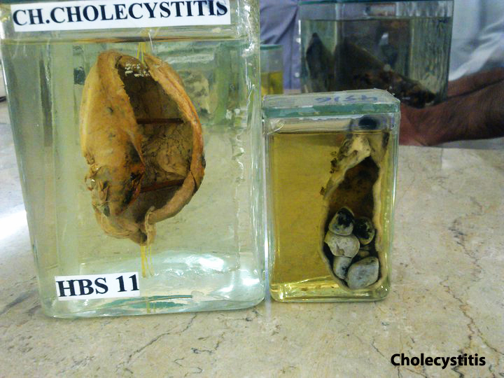 Medical Education for Students: Gross Specimens General Pathology (50 ...