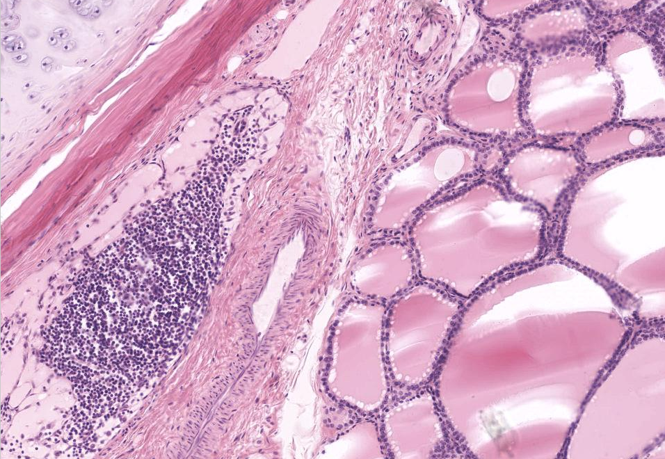 μicroscopia: TRACHEA, ESOFAGO E TIROIDE