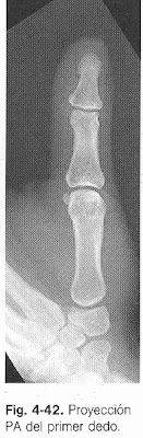 tecradiologos: PRIMER DEDO (PULGAR).