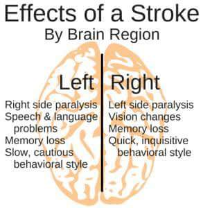 Effects Of Stroke - Family Care Physiotherapy Center