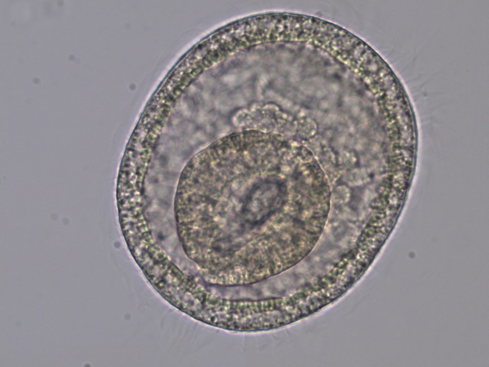 Invertebrate Embryology: Gastrulation and early actinotroch of ...