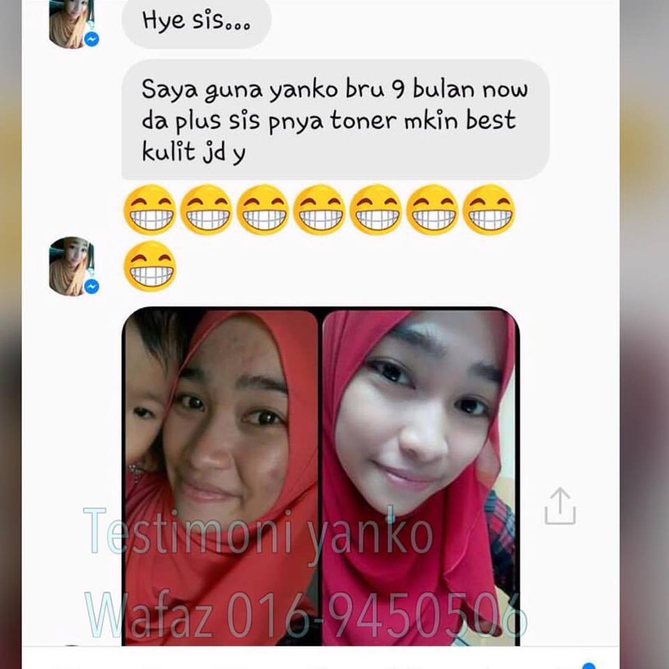Natural Health Be Young: TESTIMONI YANKO SKINCARE