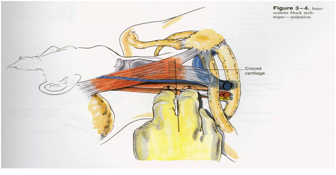 Dentistry and Medicine: Regional Anesthesia Manual—upper extremity blocks
