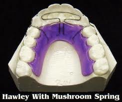 DISEÑAR LOS PATRONES DE APARATOLOGIA: PLACA DE HAWLEY CON RESORTES