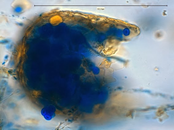 Fun With Microbiology (What's Buggin' You?): Eurotium herbariorum ...
